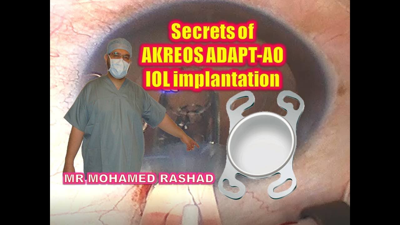 Akreos Adapt-AO Intraocular Lens IOL implantation during cataract ...