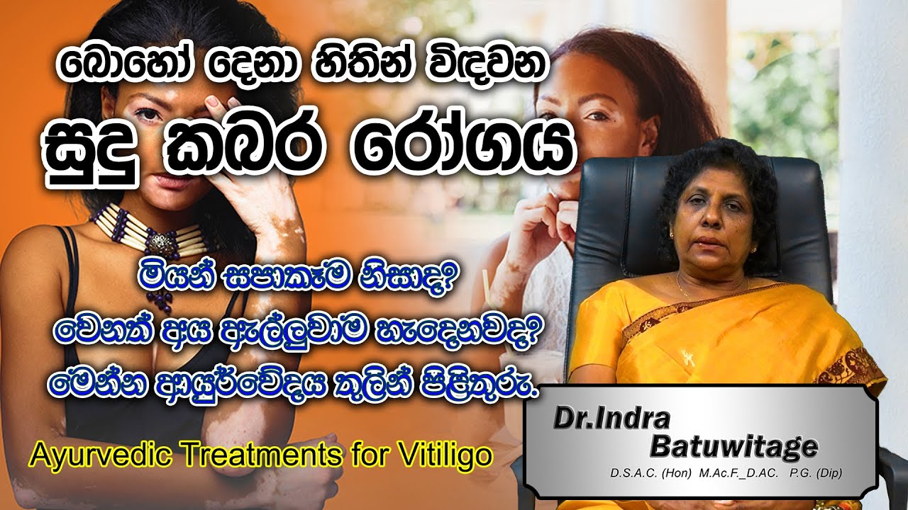 සුදු කබර රෝගය ගැන හරියට දැනගමු | Sudu Kabara | Ayurveda Treatment for ...