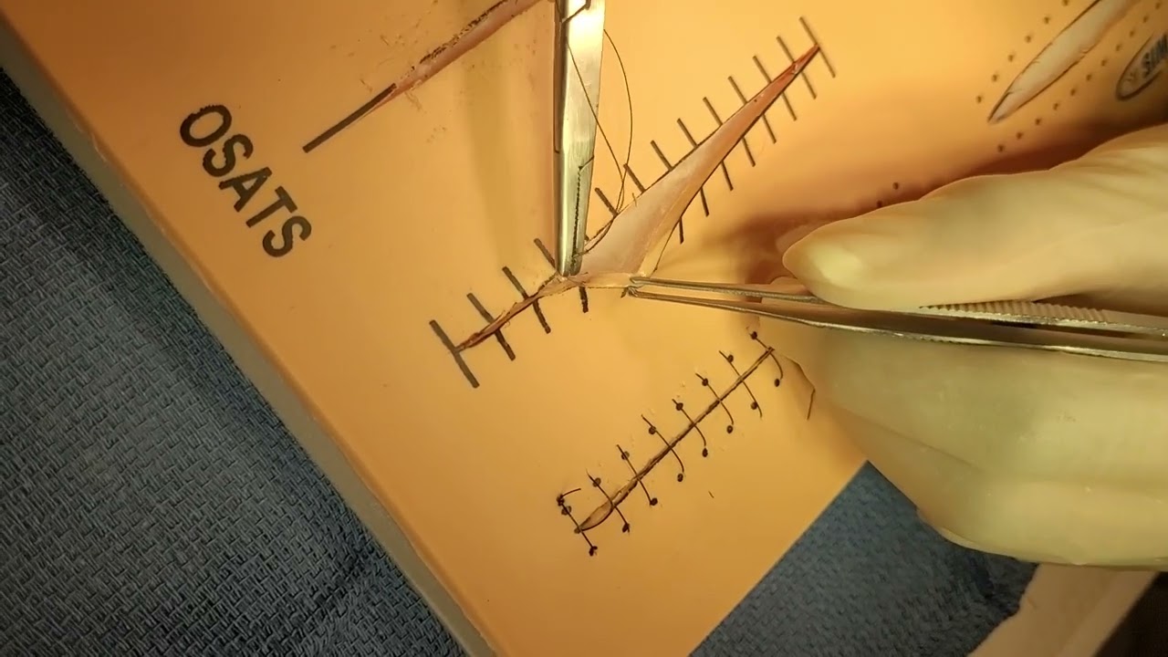 subcutaneous continuous stitch - YouTube