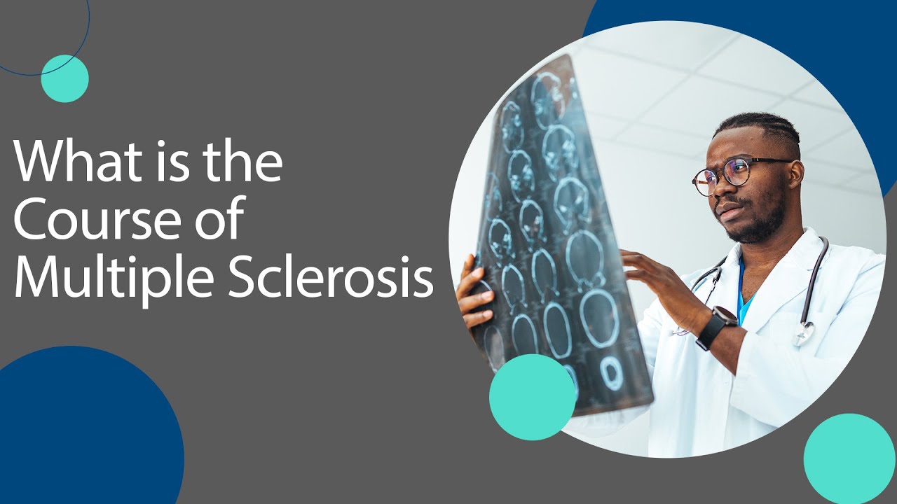 What is the Course of Multiple Sclerosis? | Ask the Experts | Sharecare ...
