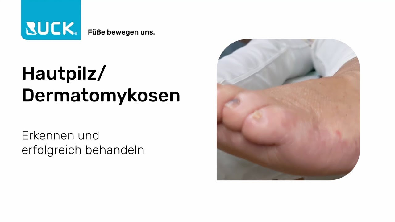 Hautpilz erkennen und behandeln - YouTube