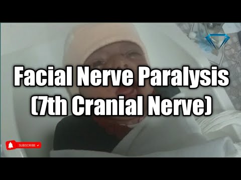 Facial Nerve Paralysis in Newborn Babies - YouTube
