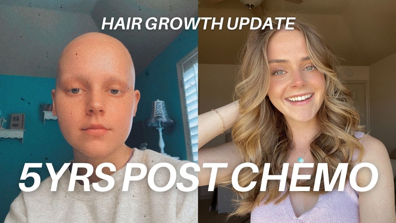5 YEAR POST CHEMO HAIR GROWTH UPDATE | Hair Growth Journey - YouTube