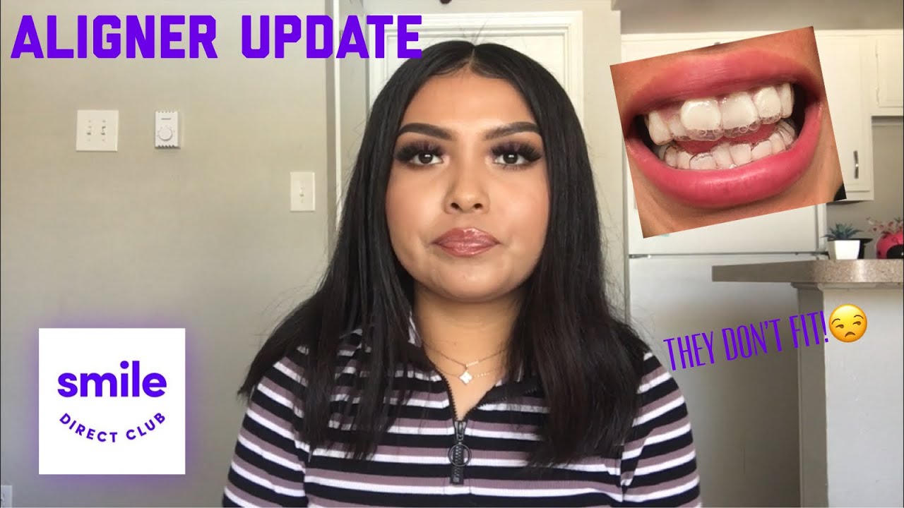 SMILE DIRECT CLUB | ALIGNER UPDATE M4 - YouTube