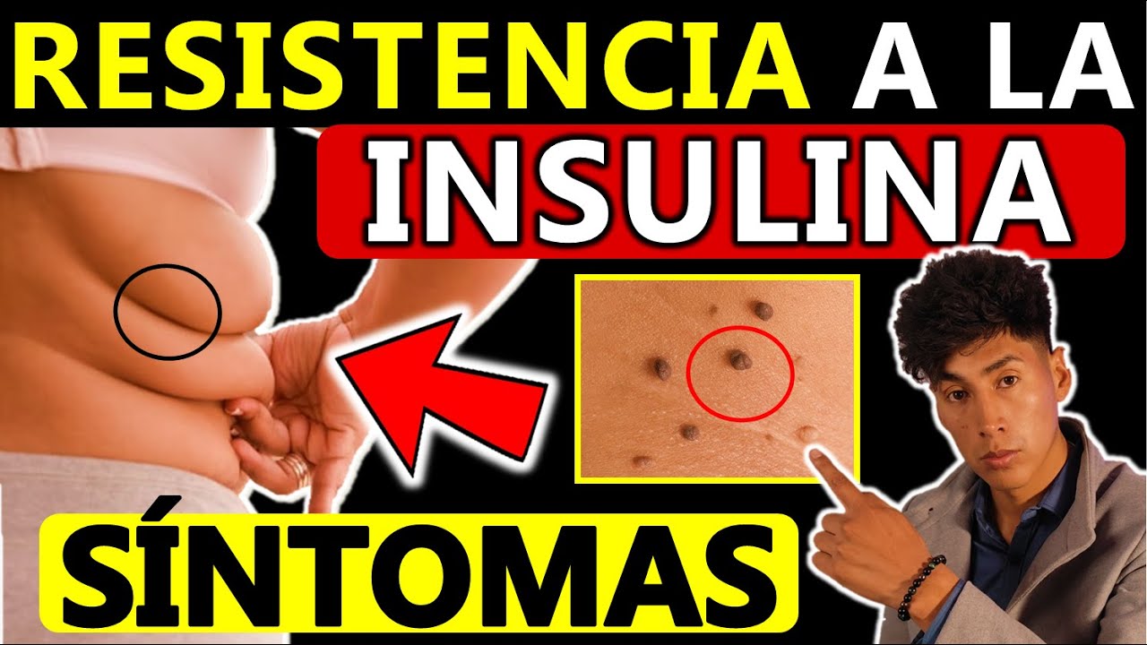 RESISTENCIA A LA INSULINA SÍNTOMAS Y COMO TRATARLA | GuiaMed - YouTube
