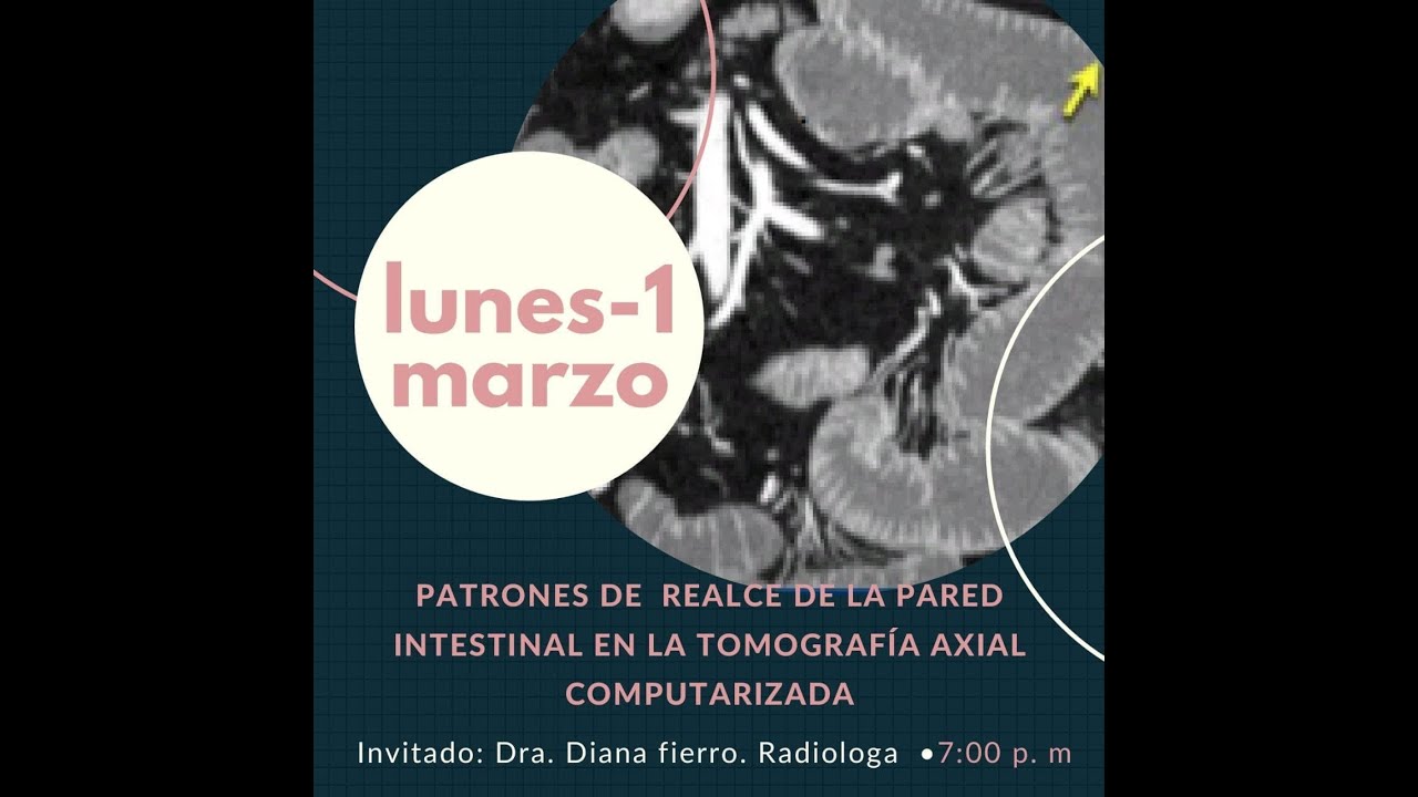 Patrones de realce de pared intestinal TAC - YouTube