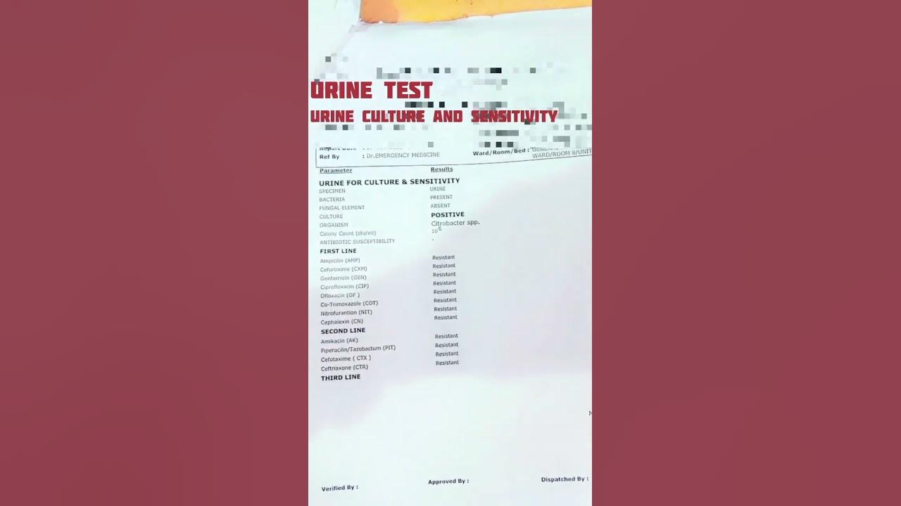Urine Test Urine Culture And Sensitivity Antibiotics faltumedico urine-test-urine-culture-and-sensitivity-antibiotics-faltumedico