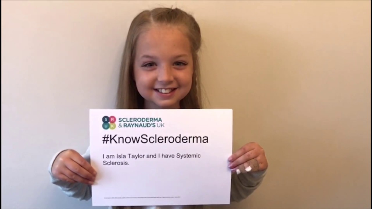 What You Need To Know About Scleroderma Youtube