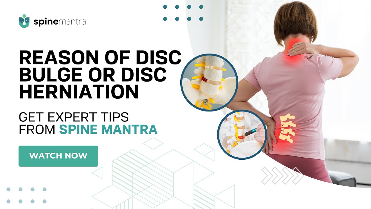 Prevent Disc Bulge with Core Strength: Expert Tips for a Healthy Spine ...