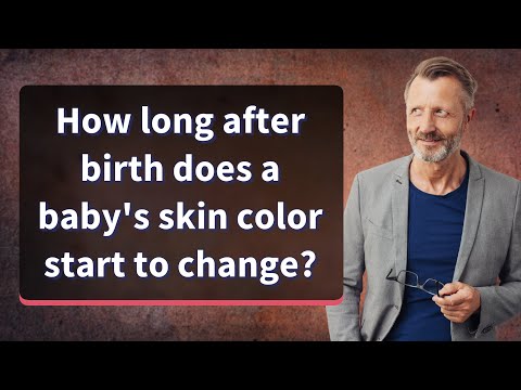 When Do Children Of Biracial Parents Develop Permanent Skin Color