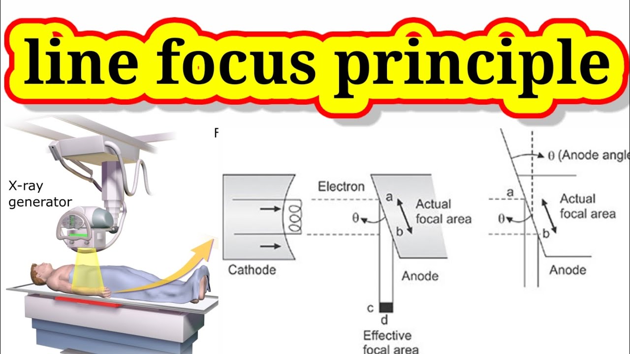 Line Focus Principle क्या है || #xray #drt #linefocus #mri - YouTube
