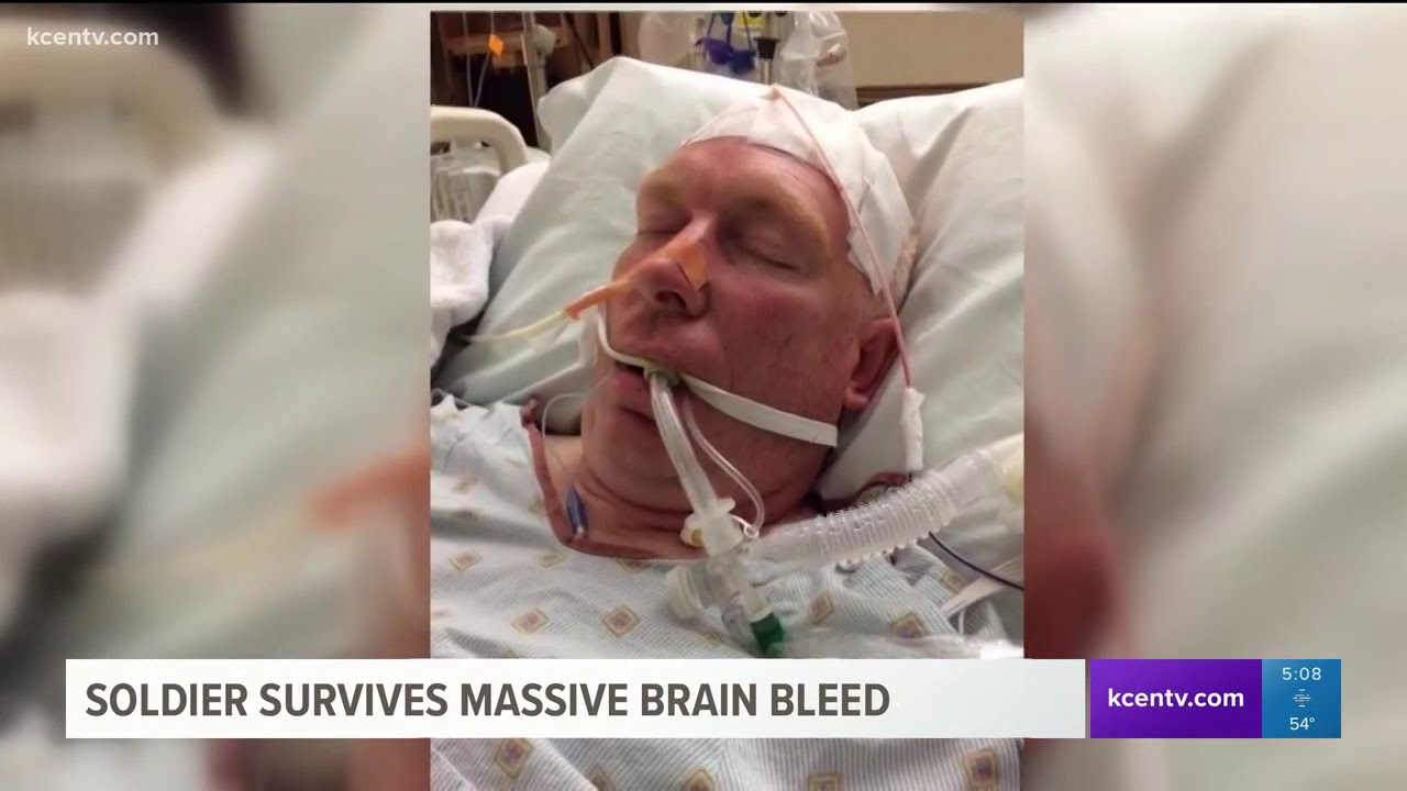Soldier survives massive brain bleed - YouTube