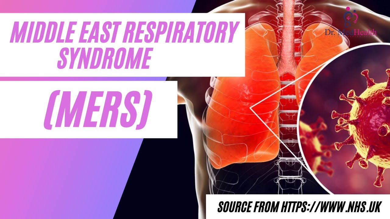 Middle East respiratory syndrome | What are the symptoms of MERS ...