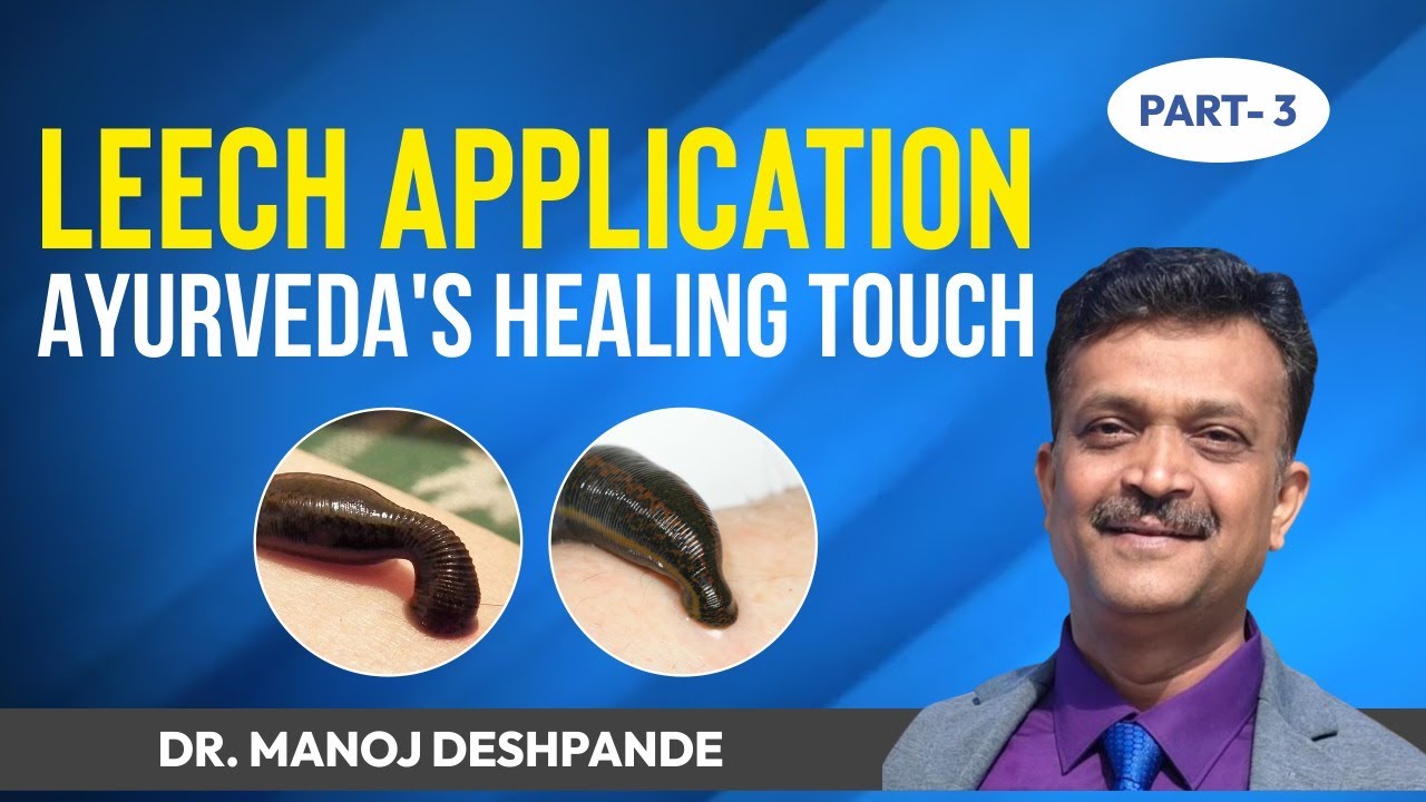 Part 3: How Leech Application Works? | Ayurveda's Healing Touch ...