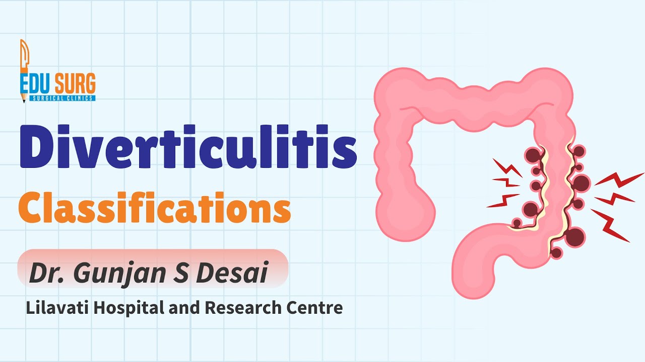 Diverticulitis Classification Simplified Modified Hinchey and Clinical ...