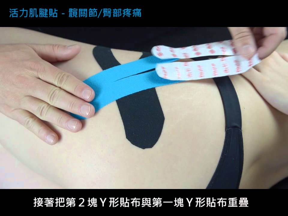 Acti-Tape 活力肌腱貼 - 髖關節/臀部疼痛 - YouTube