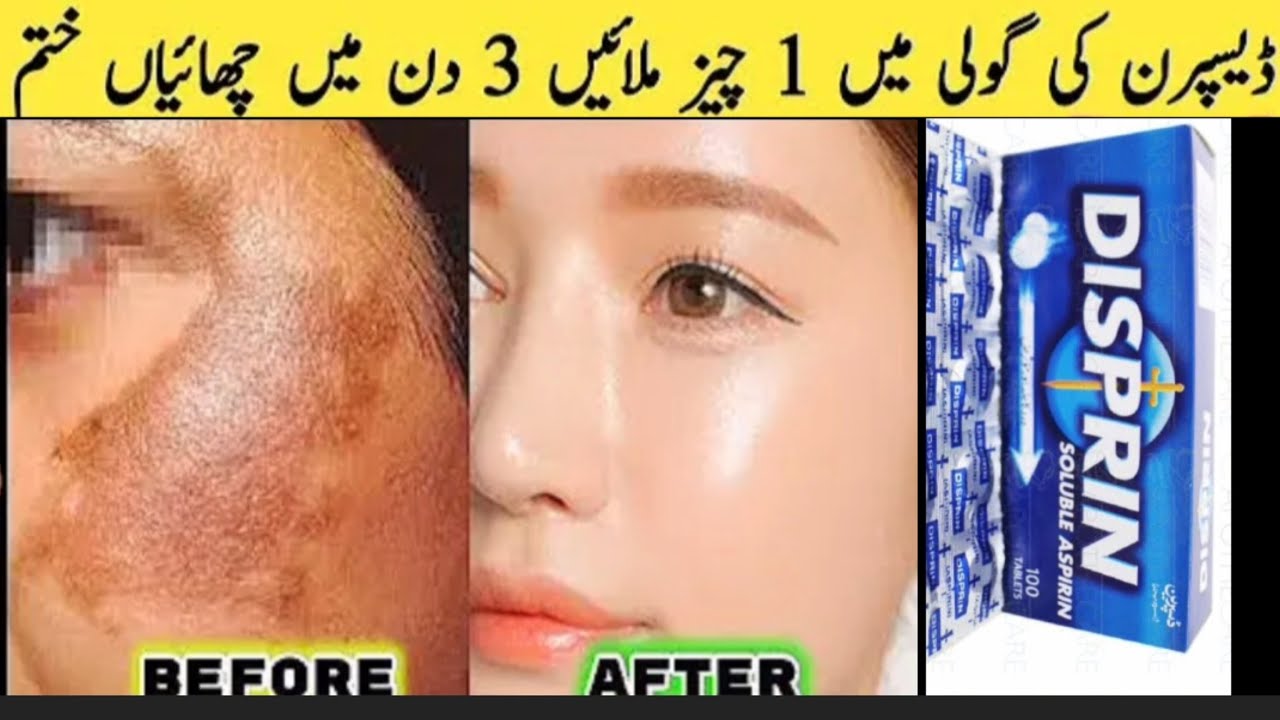 Disprin Tablet for Skin pigmentation and anti acne Get Beautiful, soft ...