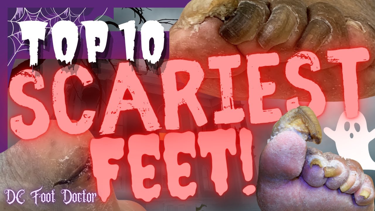 Top 10 Scariest Feet! - YouTube