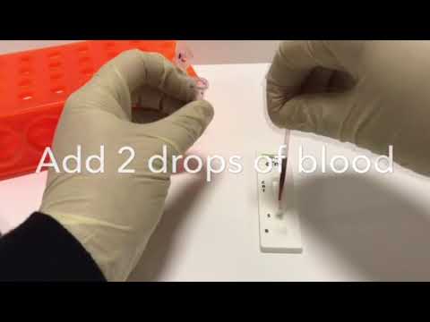Troponin I Semi Quantitative Rapid Test - YouTube