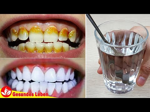 In Nur 5 Minuten | Zahnstein Und Zahnbelag Zu Hause Natürlich Entfernen ...