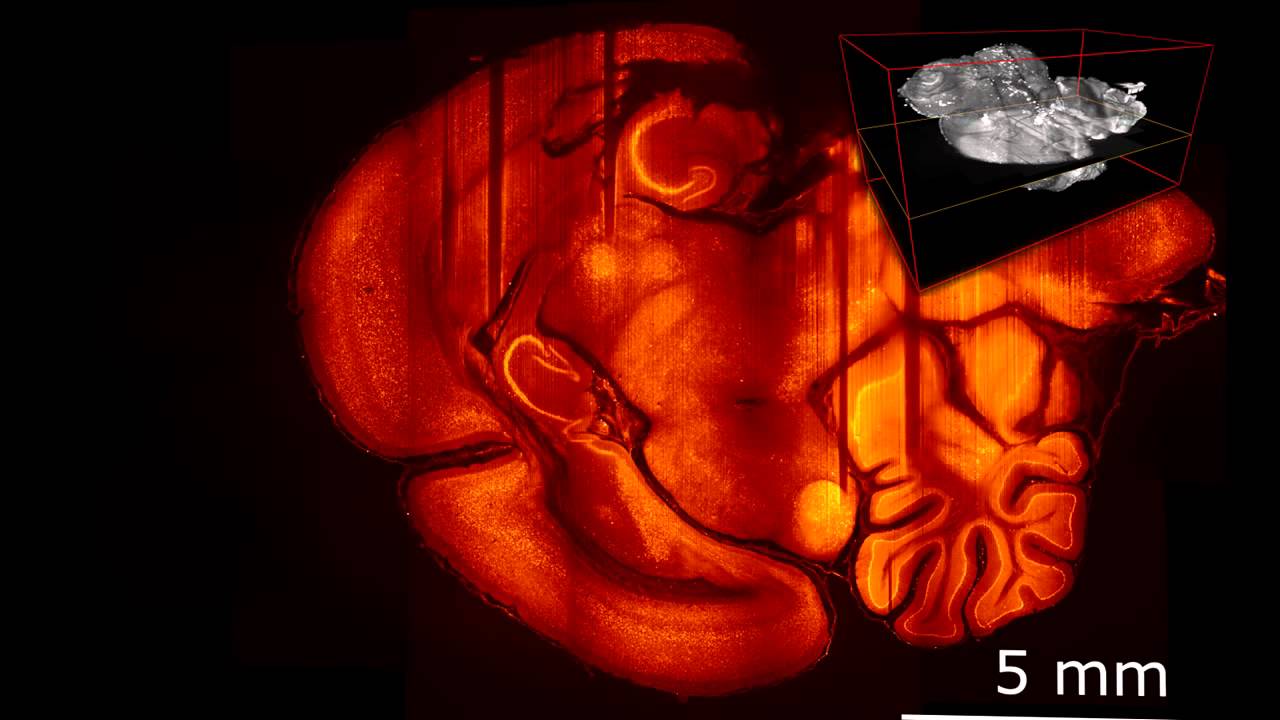 Mouse brain completely transparent - YouTube