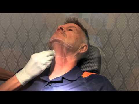 Maffi Clinics: Kybella for Men - YouTube