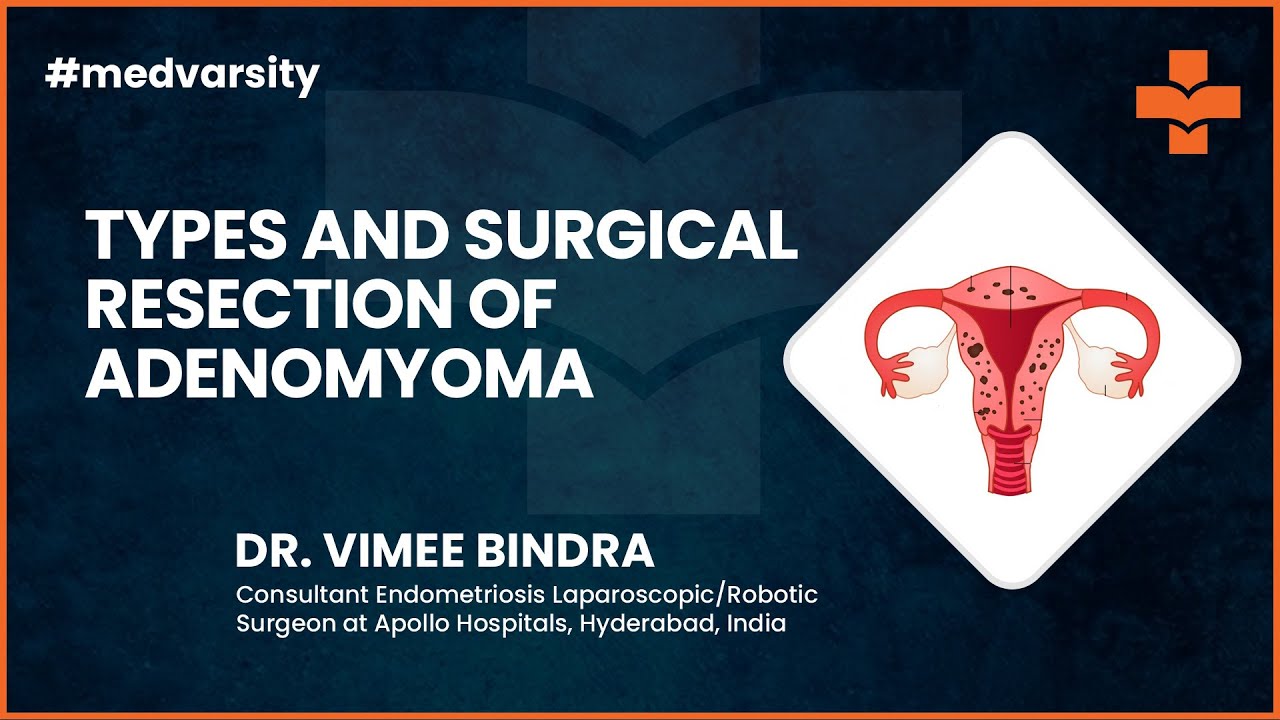 Types and Surgical Resection of Adenomyoma ...