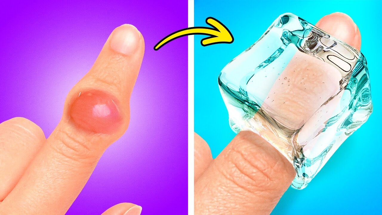 20+ Little-Known Emergency Hacks You Absolutely Need in Your Life ...