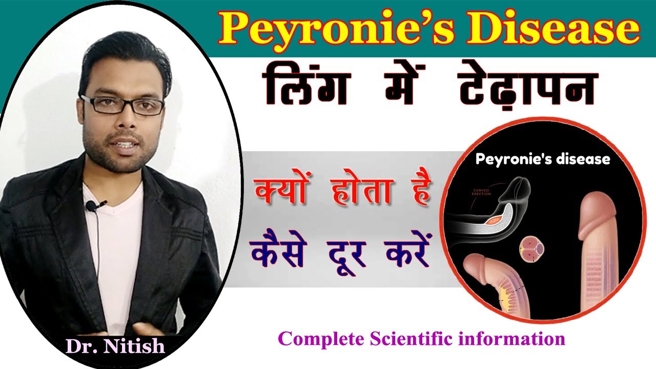 लिंग में टेढ़ापन- कारण और इलाज | Curve Penis | Peyronie’s Disease ...