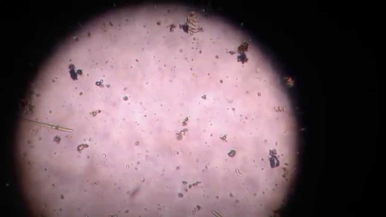 protozoos en agua estancada - YouTube