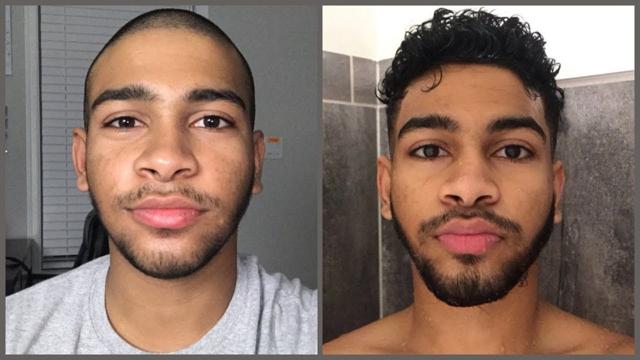 Hair (time lapse of hair regrowth) - YouTube