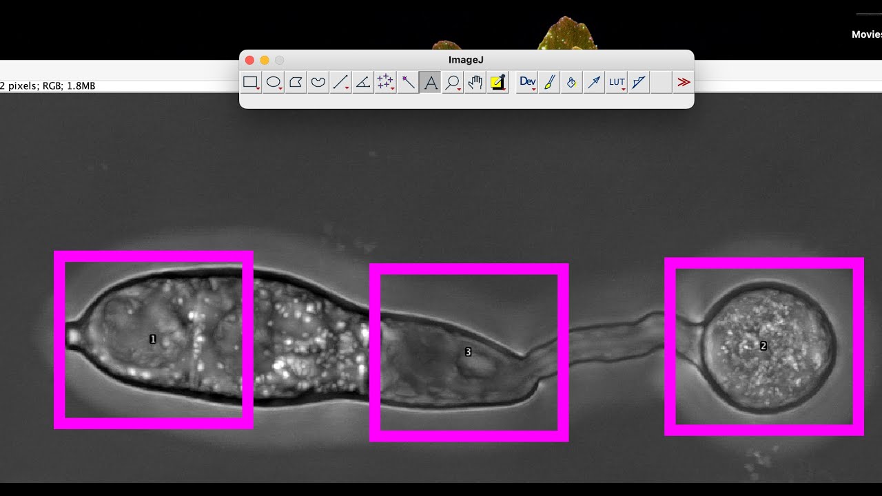 How to create ROI in ImageJ and reuse the ROI for other Images - YouTube