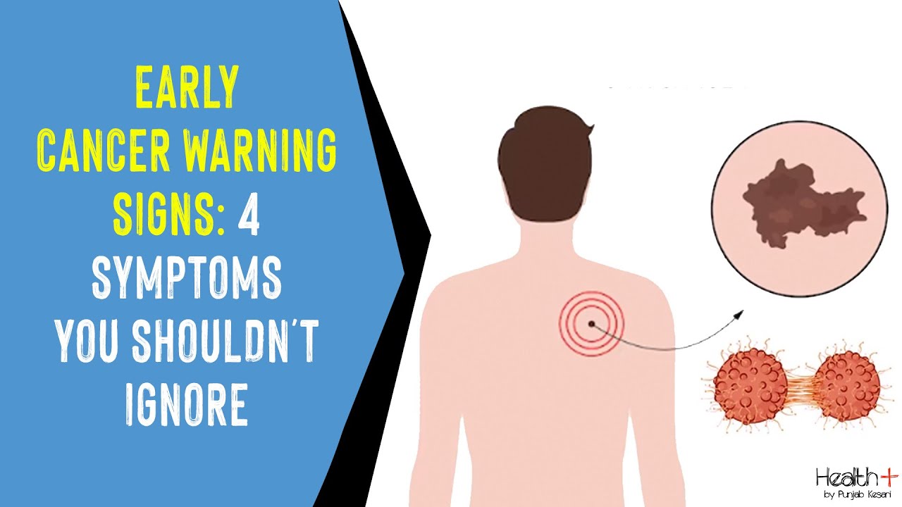 Early Cancer Warning Signs: 4 Symptoms You Shouldn't Ignore - YouTube