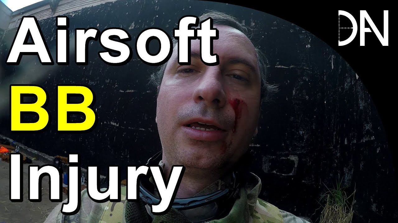 Airsoft BB Injury - Airsoft Gameplay - YouTube