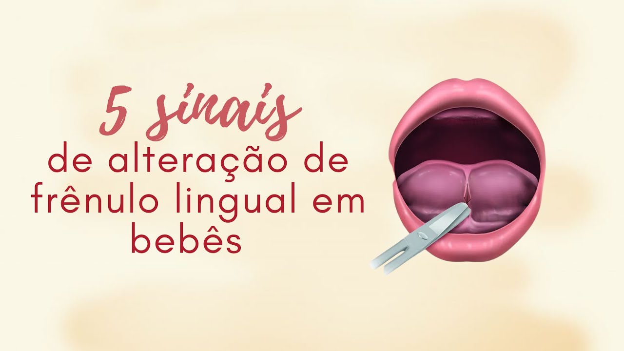 5 SINAIS QUE SUGEREM ALTERAÇÃO DE FRÊNULO LINGUAL NO BEBÊ - YouTube