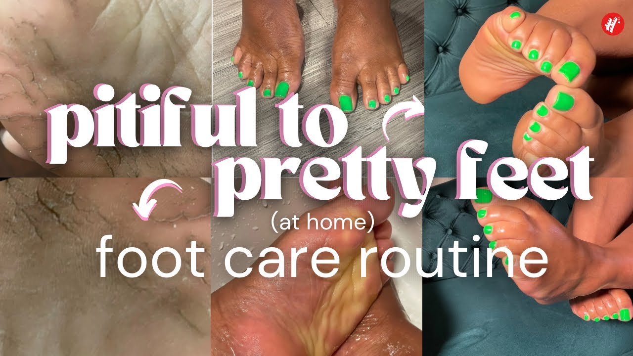 DRAMATIC 🦶TRANSFORMATION | Revealing My Secrets to Soft Feet | Foot ...