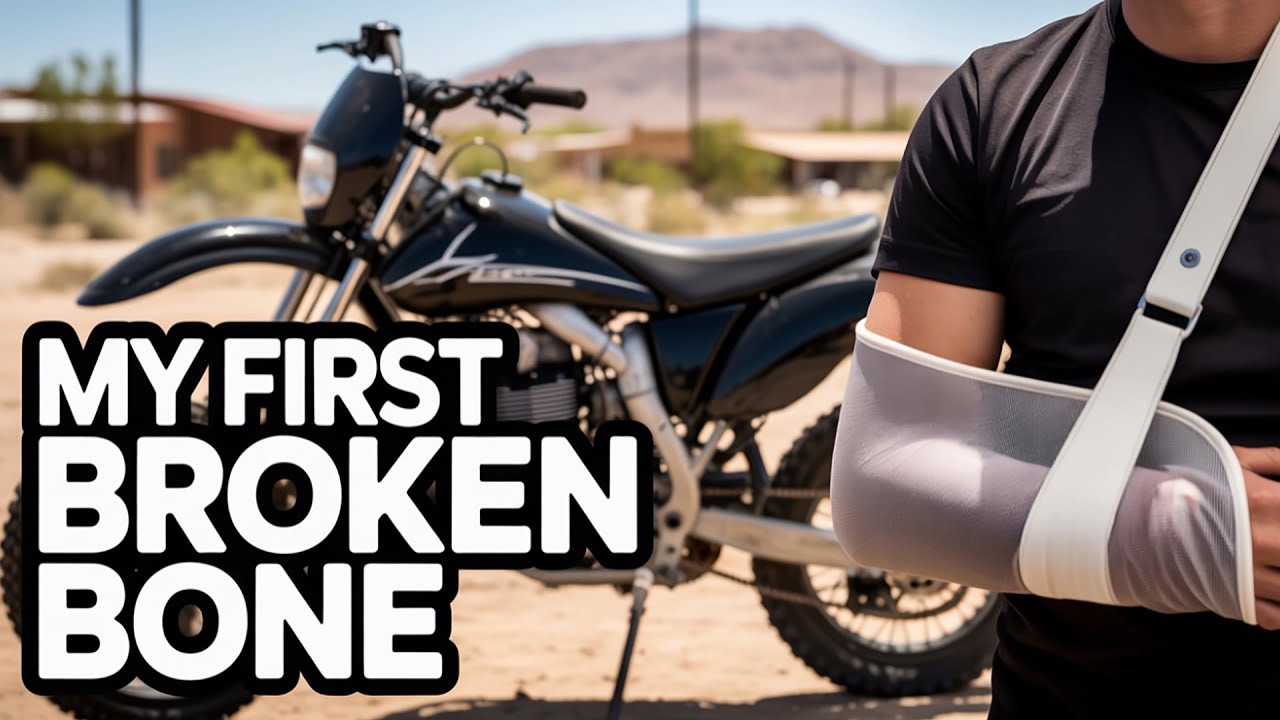 I broke my first bone - YouTube