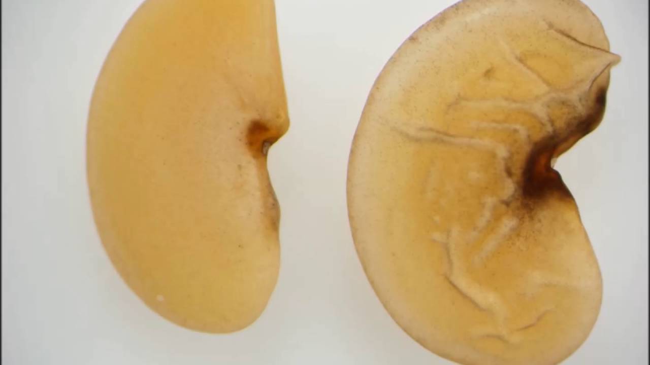 A class II KNOX gene, KNOX4, controls seed physical dormancy - YouTube