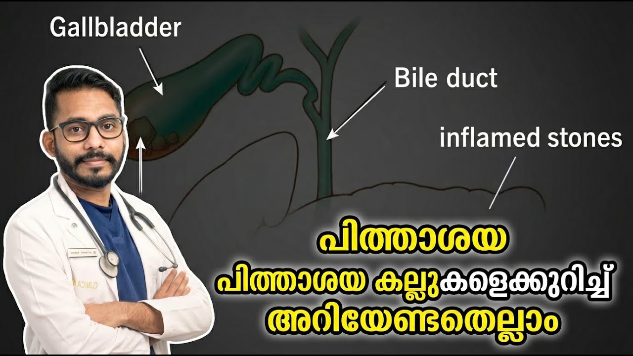 പിത്താശയക്കല്ല് പുറത്തെടുക്കുന്ന ചികിത്സയുടെ കാണാപ്പുറങ്ങൾ | truth ...