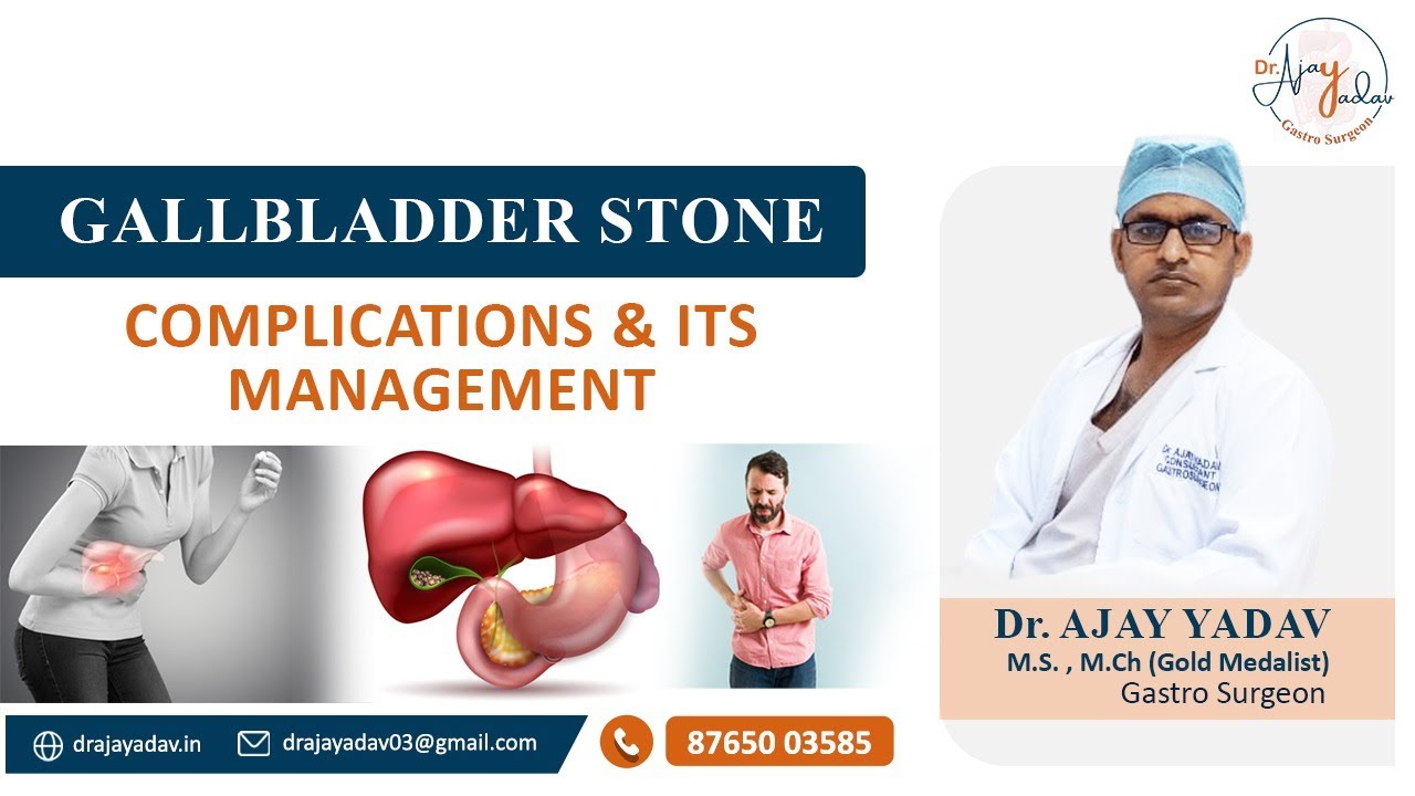 Gall Bladder Stones - Complications & its Management - YouTube