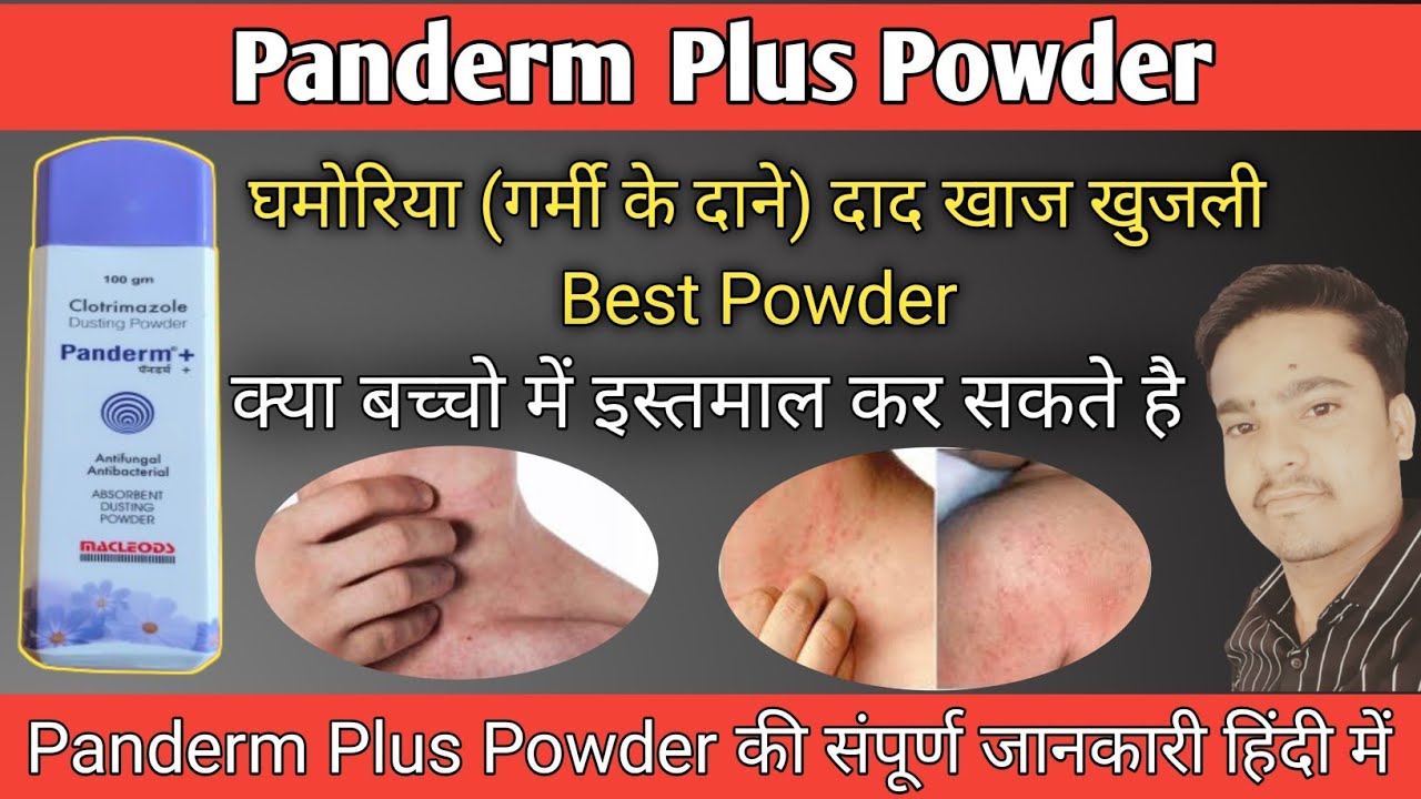 Panderm Plus Powder | Clotrimazole Powder Uses | Clotrimazole Dusting ...