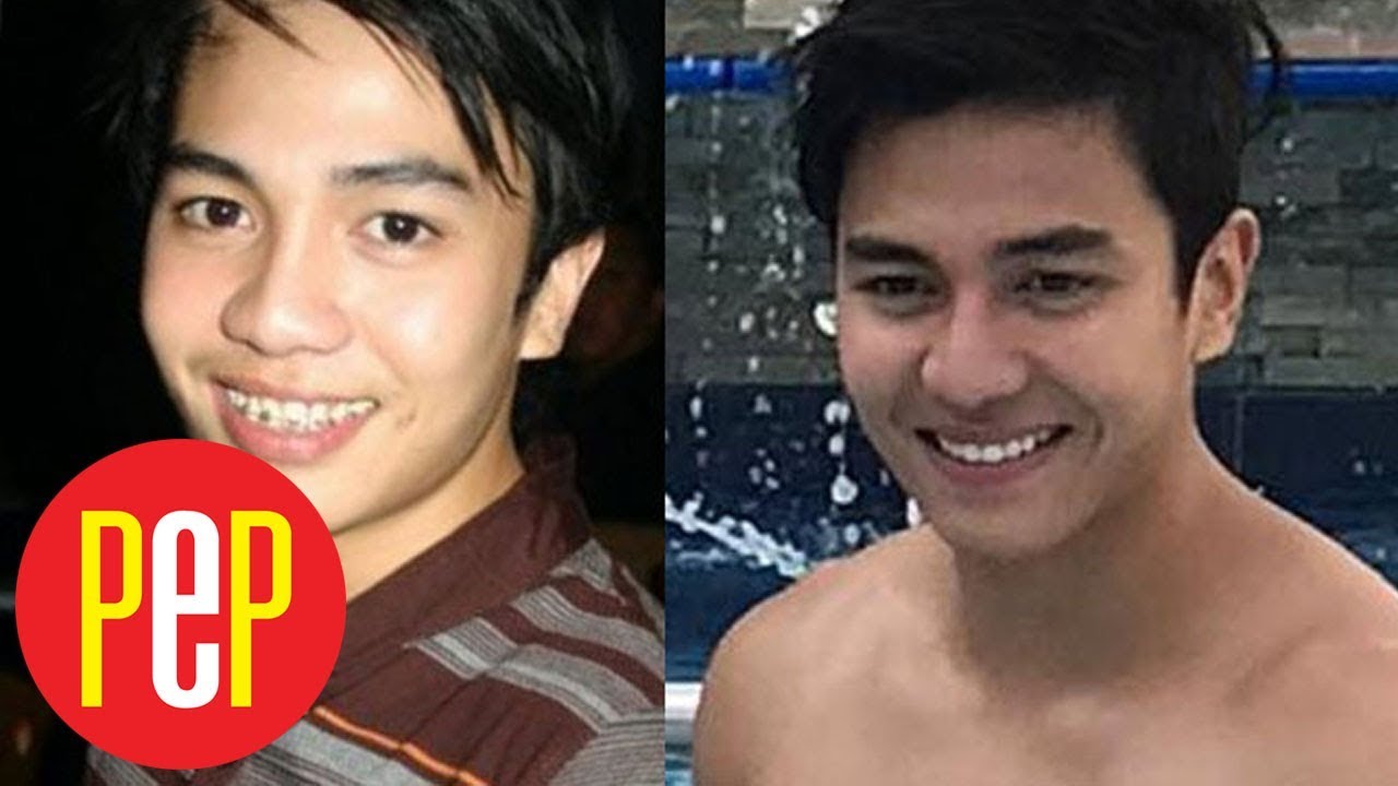 Jak Roberto on nose job rumor: "Puwede naman." - YouTube