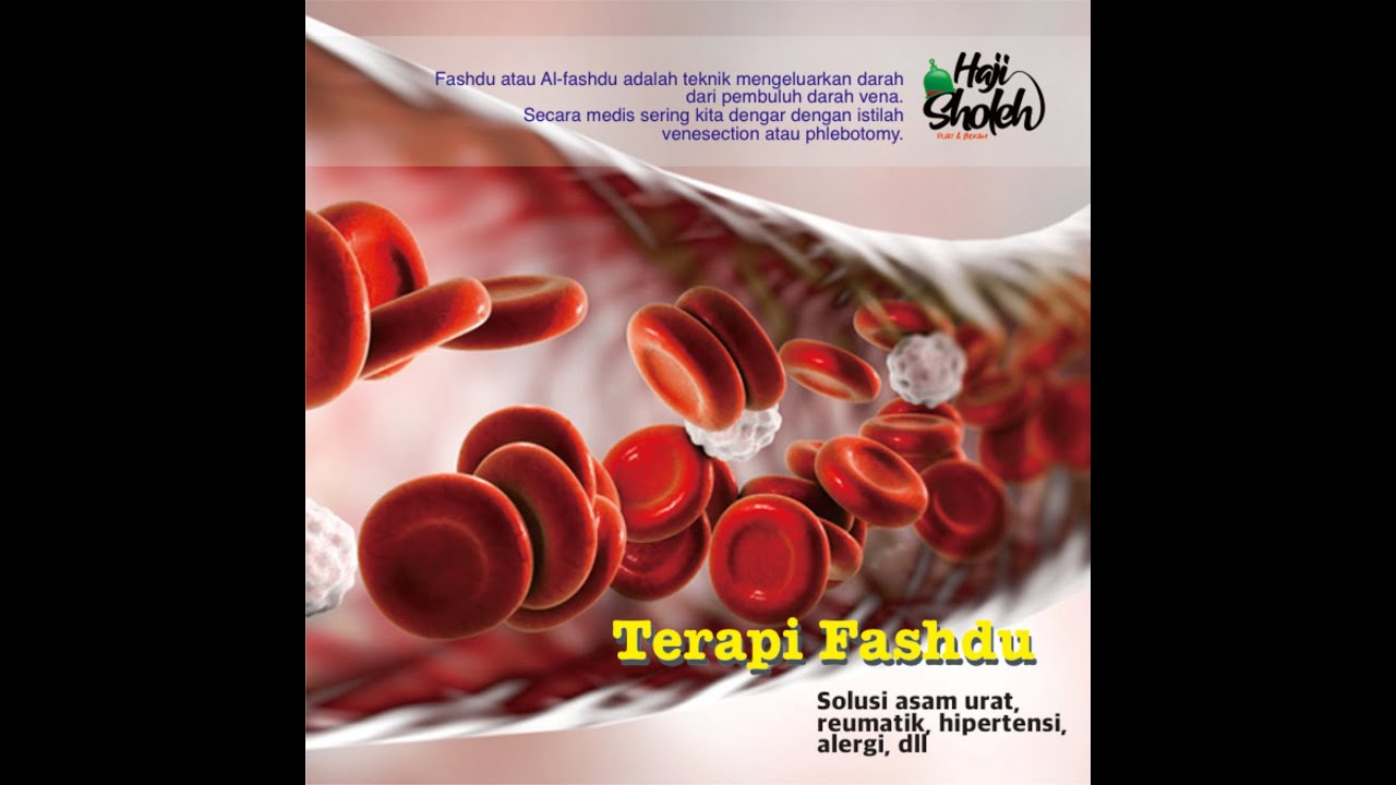 Terapi Fashdu, untuk berbagai keluhan kaki anda.. - YouTube