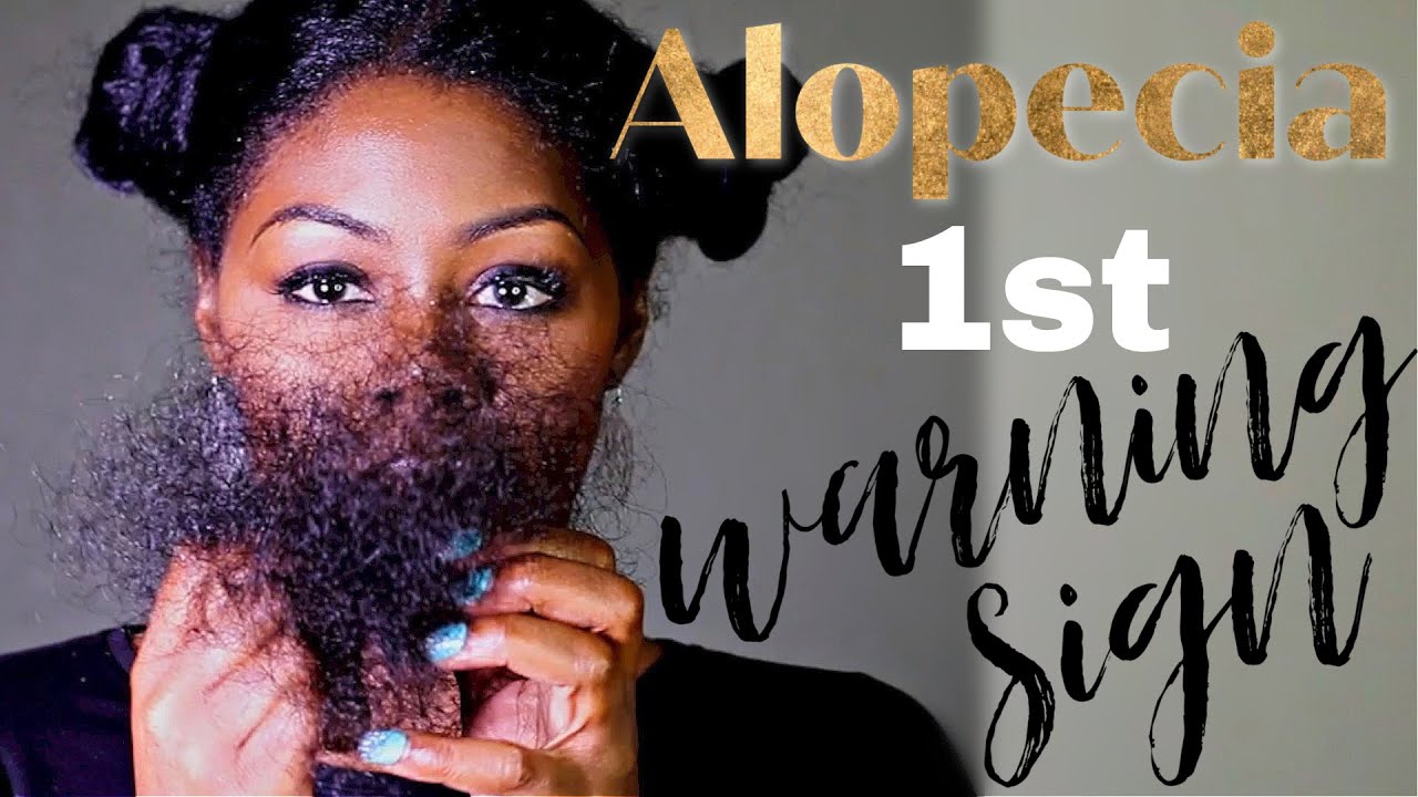 Alopecia: FIRST warning sign. What to look for. - YouTube