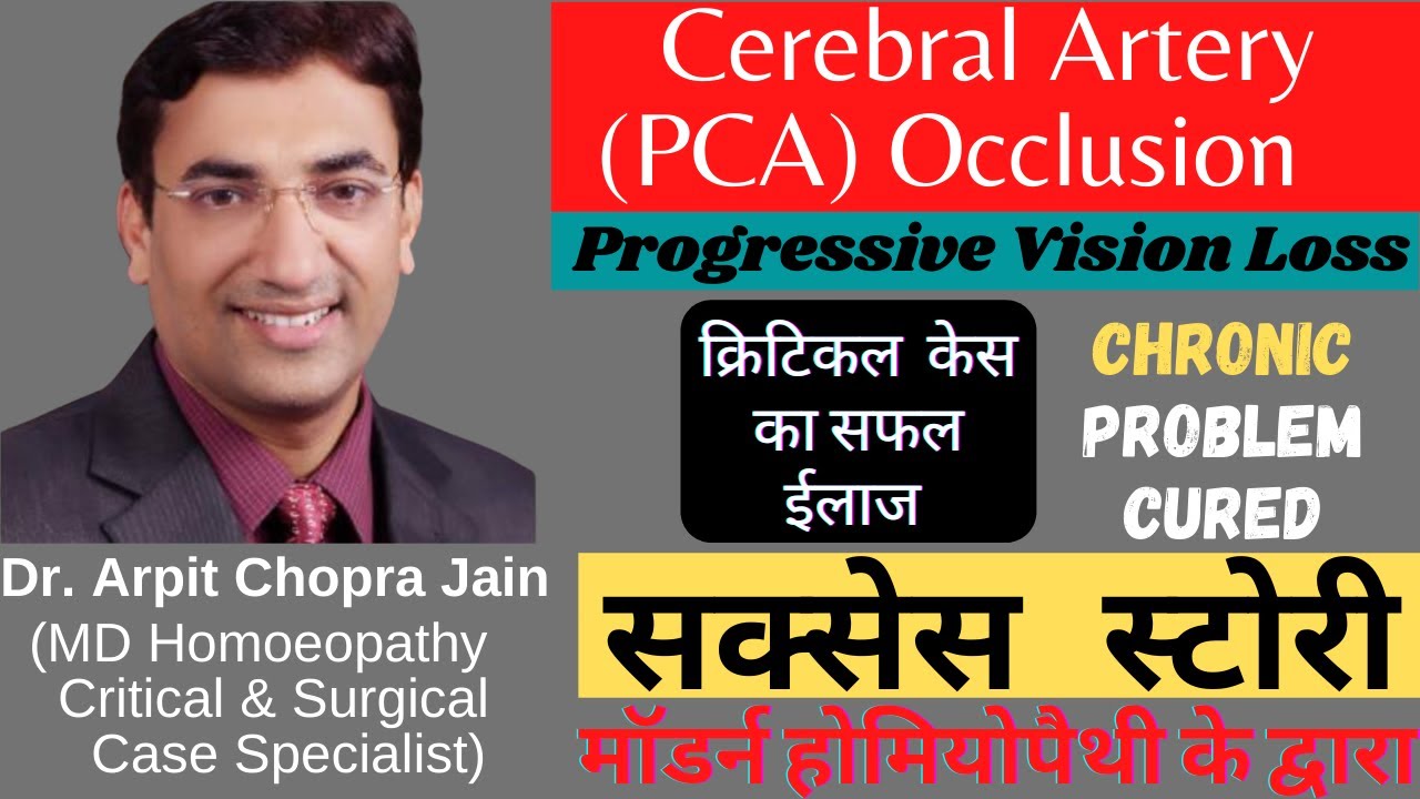 Cerebral Artery (PCA) Occlusion| Progressive Vision Loss | Dr. Arpit ...