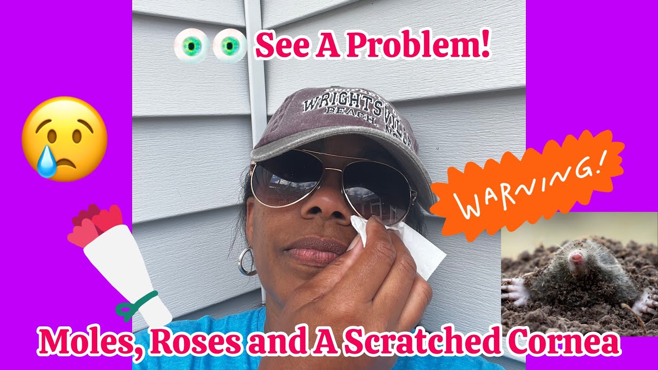 Moles, Roses and a Scratched Cornea - Protect Your Eyes - YouTube