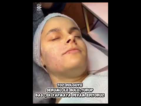 COLLOGEN SERUM + TOZ