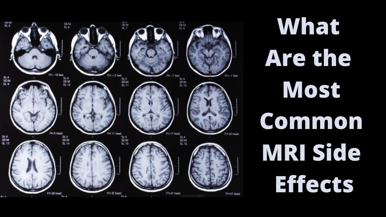 What Are the Most Common MRI Side Effects - YouTube