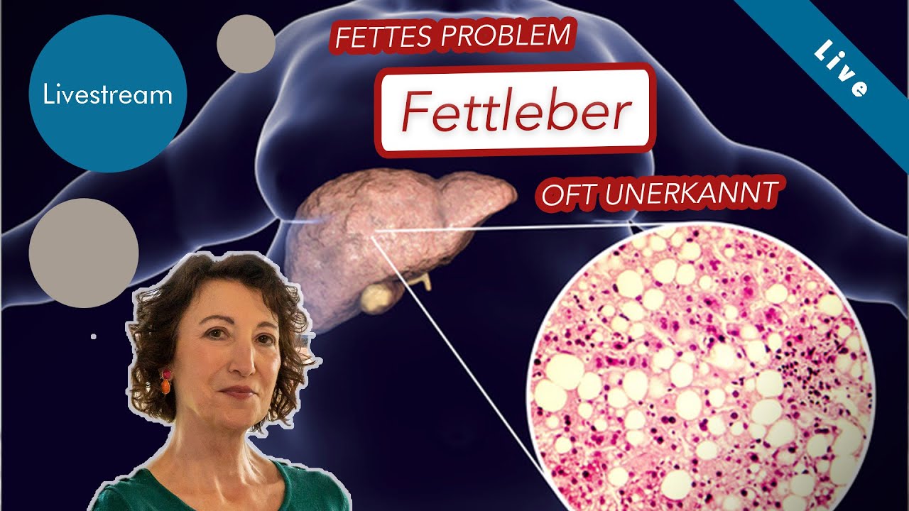 So heilen Sie Ihre Fettleber! Live am 22. August um 18:00 Uhr - YouTube