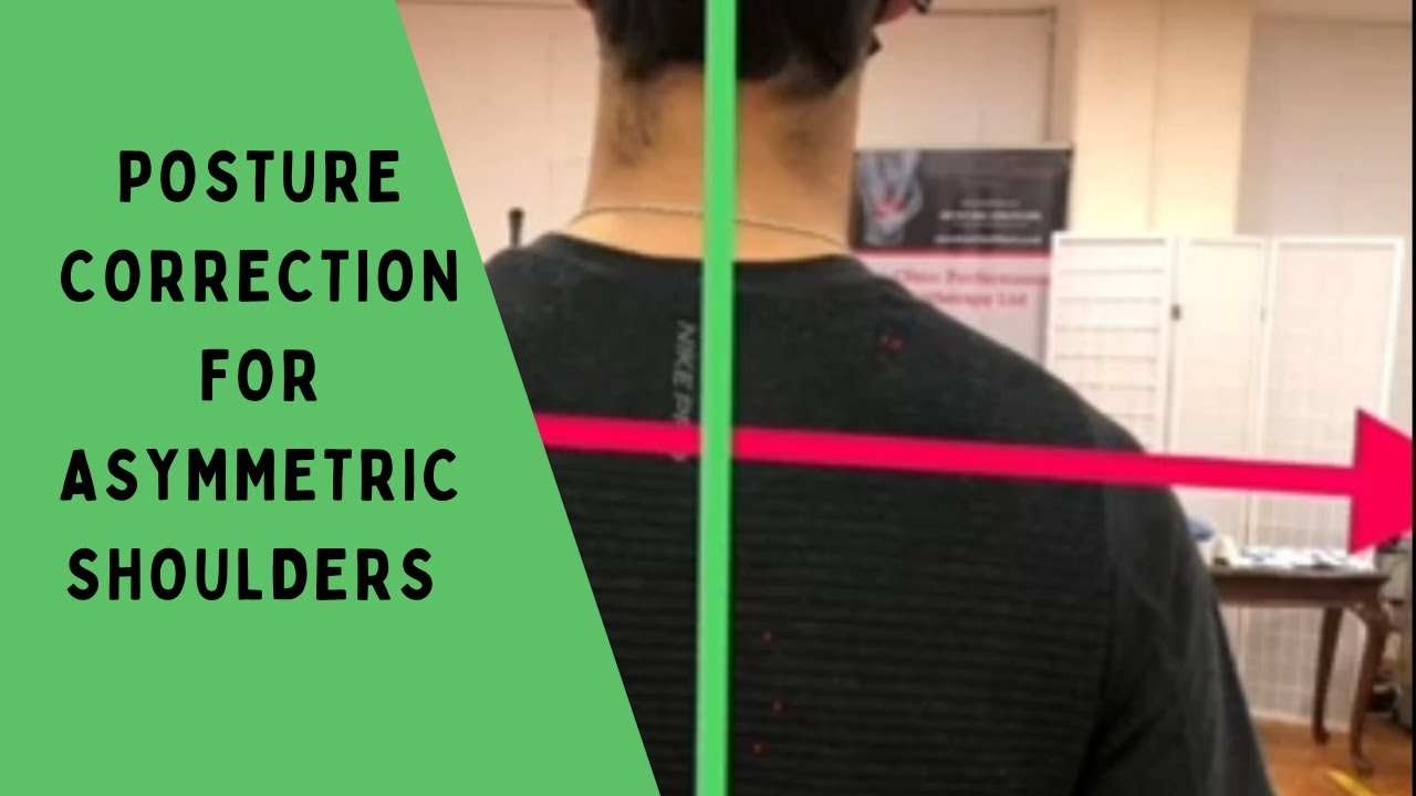 🧍‍♂️ Posture Correction for Asymmetric Shoulders + 🧘 Tips | 🩺 - YouTube